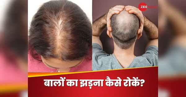 Hair Fall Problem How to overcome Baldness Home Remedies Ganjapan Pyaaz ...