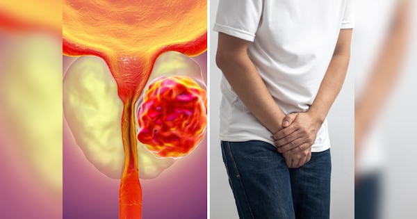 This cancer targets only men run to doc as you see these 7 symptoms ...