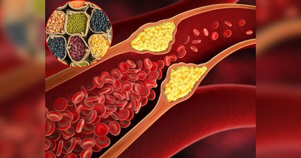 Benefits of eating pulses will remove bad cholesterol from your body ...