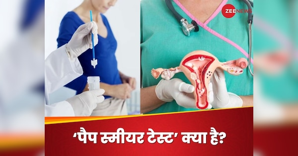 Cervical Cancer can be detected at first stage through Pap Smear Test ...