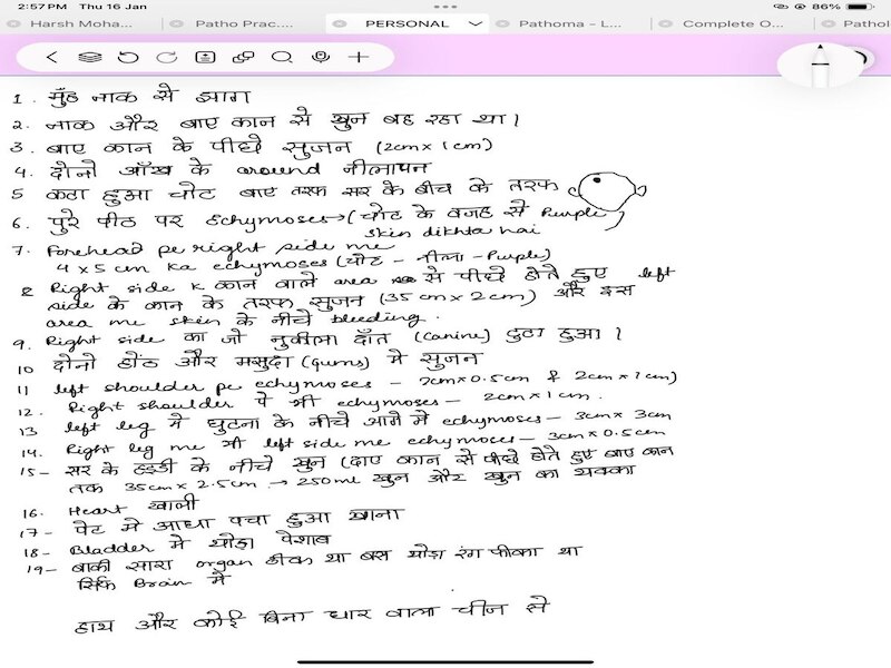 Sahil murder case candle march was taken out for justice in Bagaha | नाक-कान से खून...आंखों में ...