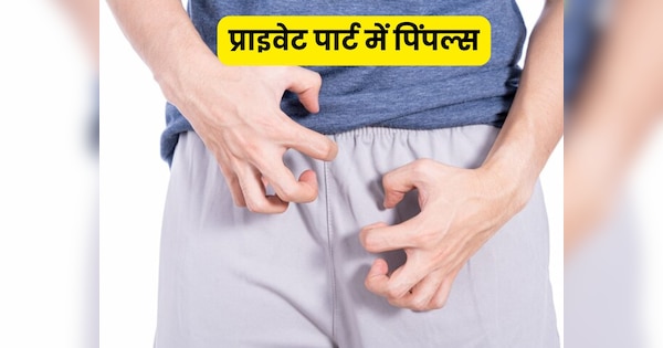 What Cause Pimple on Penis Male Private Part Lump Treatment and Similar ...