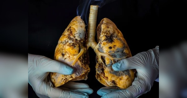 how long does it take to remove tar deposit in lungs heart after ...