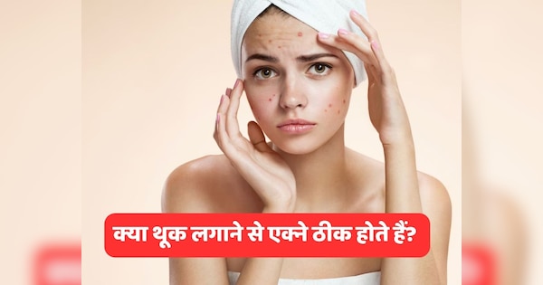 Can your saliva cure acne | Does morning saliva help get rid of pimples ...