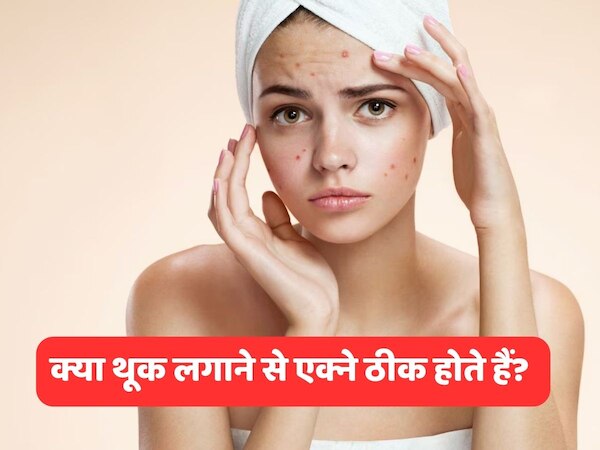 Can your saliva cure acne | Does morning saliva help get rid of pimples ...