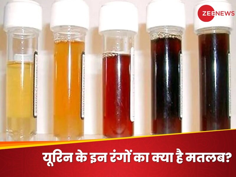 What Urine Colours Says Its Meaning peshab ke rang se jane bimari Ka ...