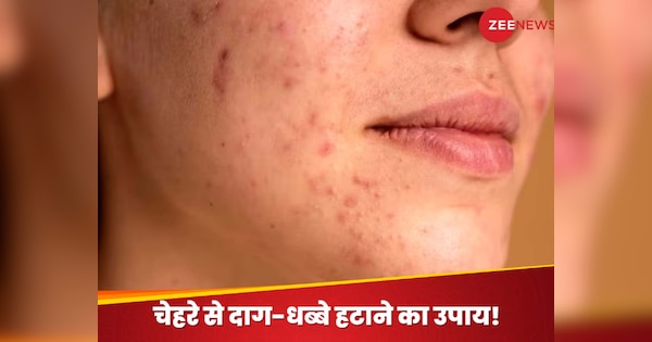 Chehre Par Gulab Jal Lagane ke Fayde How Rose Water Beneficial to ...