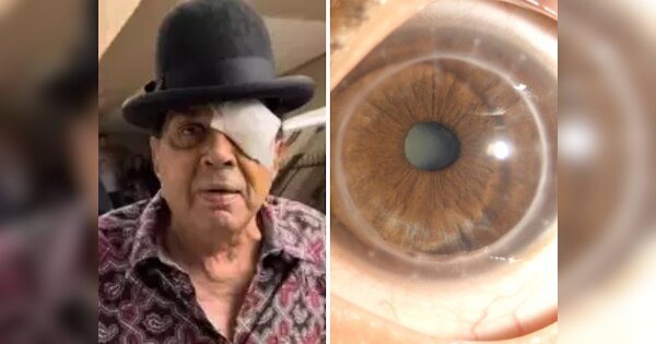 actor Dharmendra 89 yrs old had to undergo eye surgery know what is Eye Grafting | मेरी आंख ...