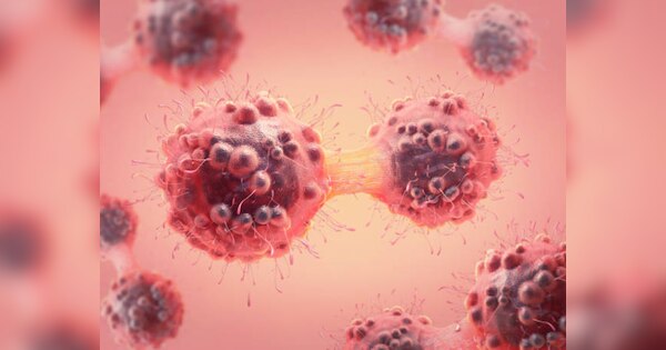 when cancer comes back is it worse which cancer has highest recurrence ...