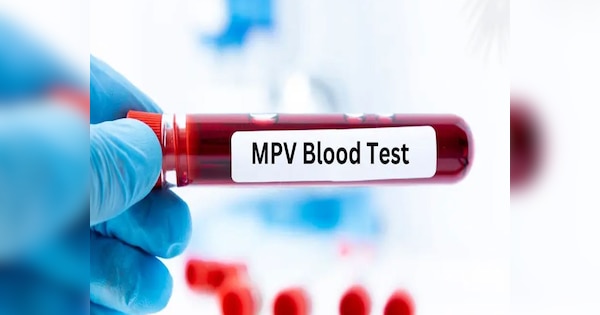 What is MPV mean platelet volume its Danger Symptoms Cure What To Eat Treatment Diet | एमपीवी ...