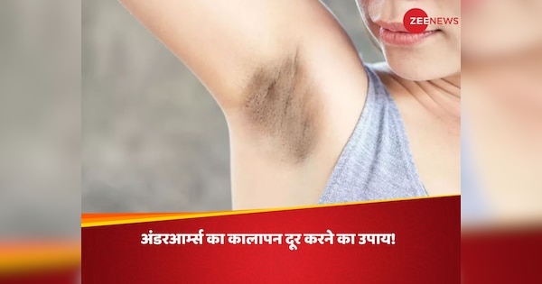 curd mixed with turmeric can remove underarm darkness at home | दही में ...