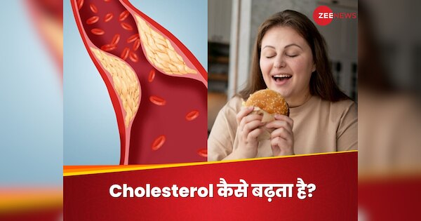 Top 5 Bad Habits That Leads To Jump in High Cholesterol Level LDL Need ...