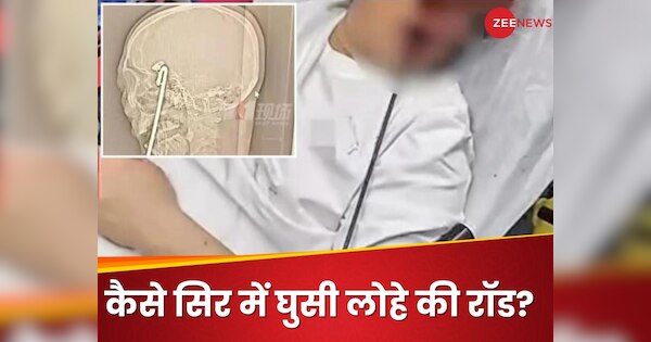 Horrible accident on dining table 15 inch iron rod penetrated the man ...