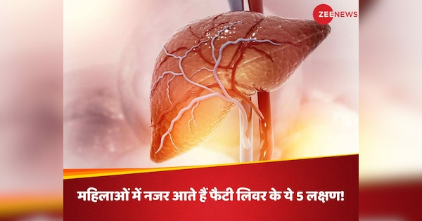 Weight loss to yellow skin these 5 early fatty liver symptoms in women ...