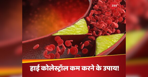 paan ke patte khane ke fayde | हाई कोलेस्ट्रॉल कम करने के उपाय ...