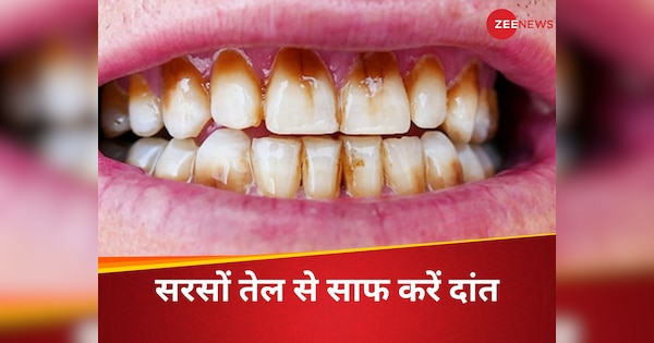 cleaning yellow teeth with mustard oil it helps you to naturally whiten ...