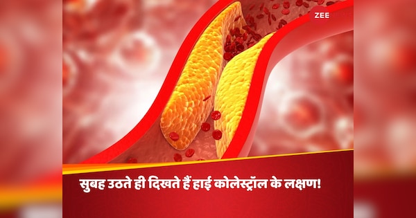 high cholesterol ldl symptoms signs show in the morning | सुबह उठते ही ...