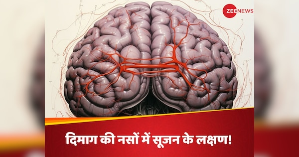 दिमाग में सूजन के लक्षण | symptoms of swelling in brain nerves | दिमाग ...