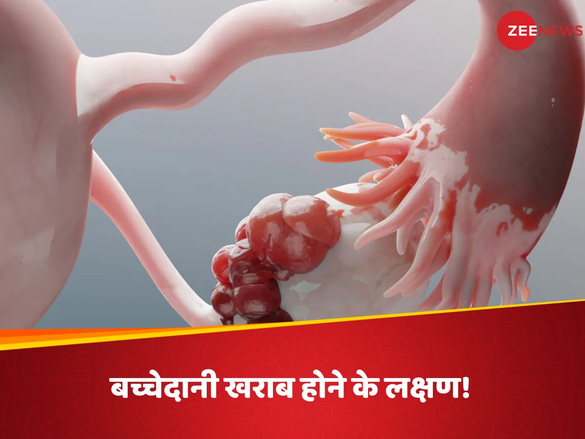 बच्चेदानी खराब होने के लक्षण | uterus problem symptoms | बच्चेदानी ...