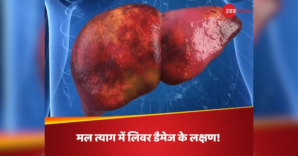 मल त्याग में लिवर डैमेज के लक्षण | liver damage symptoms in Stool ...