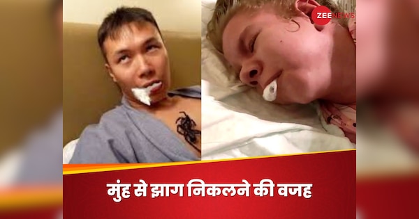 Foaming at the Mouth Main Main Cause Seizures Drug Overdose Poison Munh ...