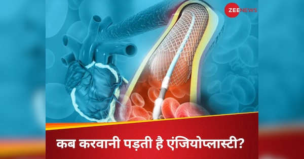 gums Bleeding leg pain heart beating in a danger angioplasty may have ...