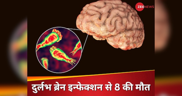 Rare brain infection killed 8 people in Tamil Nadu after routine dental ...