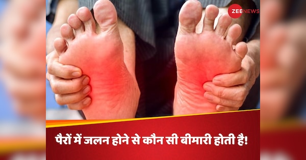 पैरों में जलन होने से कौन सी बीमारी होती है | causes of burning ...