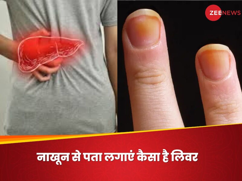 Liver Disease Symptoms Warning Signs From Nails Nakhoon se Bimari Ke ...