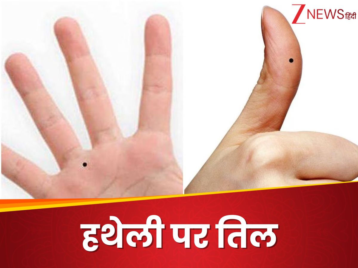 lucky moles on hand hatheli par til hone ka matlab palmistry | हथेली के ...