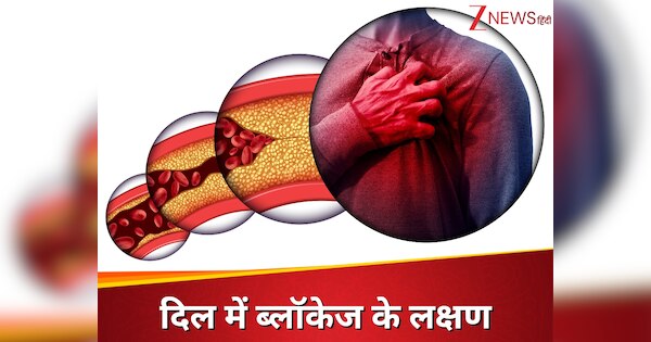 Do not wait for heart attack check for a heart blockage at home with ...