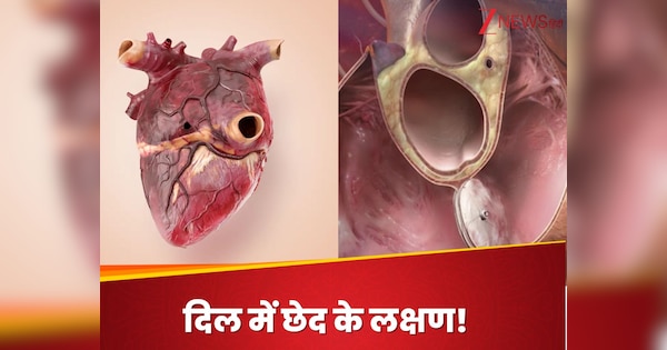 hole in heart symptoms | दिल में छेद की समस्या लक्षण | ventricular ...