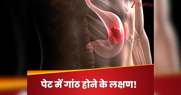 पेट में गांठ होने के लक्षण | pet me ganth hone ke lakshan | पेट में ...
