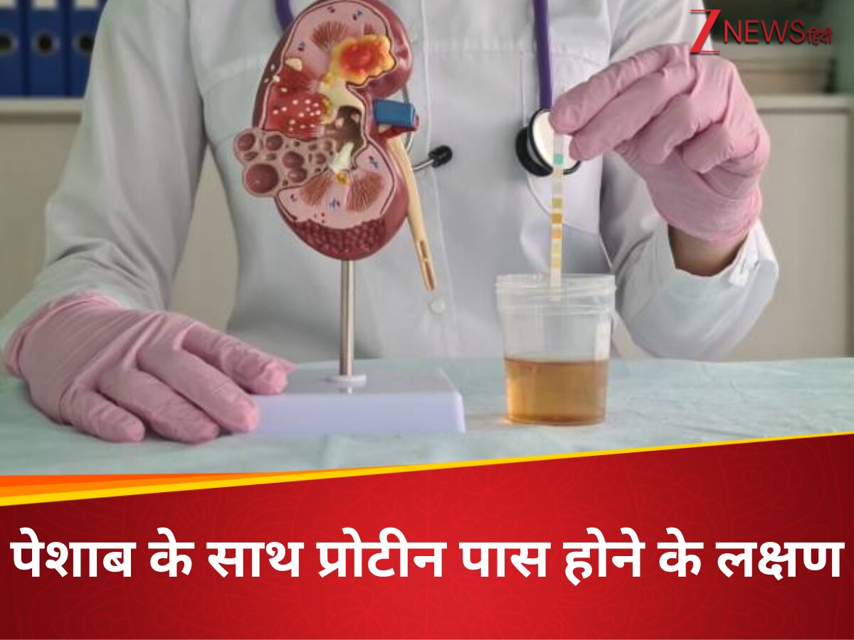 5 symptoms of proteinuria kidneys damage entire protein of body ...