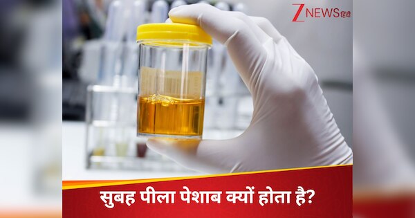 why urine color is dark yellow in the morning know the reason behind it ...