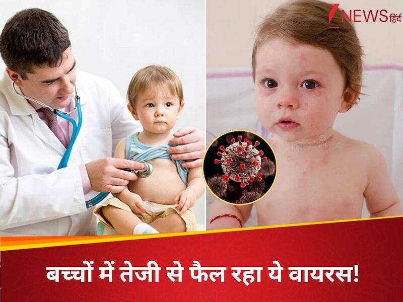 what is roseola virus why this infection affects children by age 2 ...