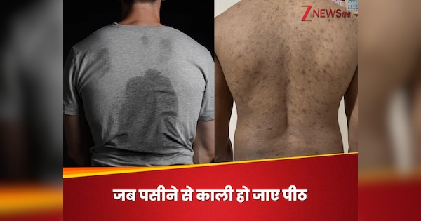 Due to these carelessnesses black Dark spots of sweat start forming on ...