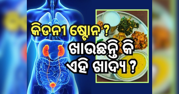 All these things increase the risk of kidney stones