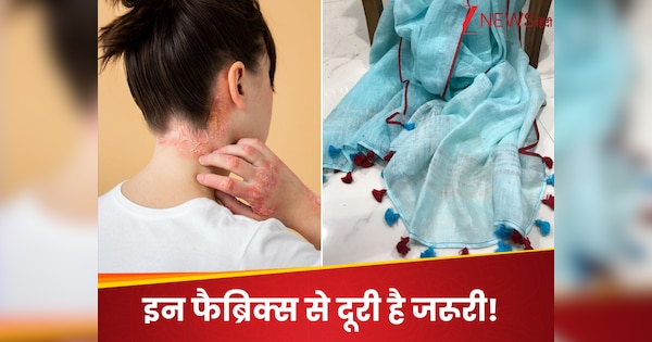 avoid these fabric clothes in monsoon allergic fabric skin irritation ...