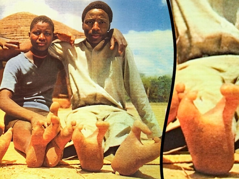 Weird Tribes Vadoma has only two toes no fingers on their feet ...