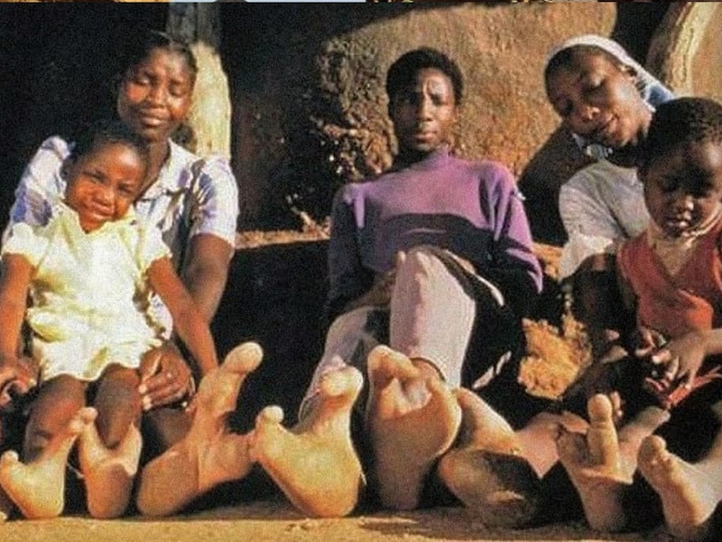 Weird Tribes Vadoma has only two toes no fingers on their feet ...