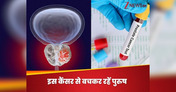 Prostate Cancer Male Private Part Gland Its Symptoms Which is ...