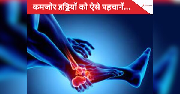 Bone Damage Early Signs How do I know if my bone is damaged |कमजोर होती ...