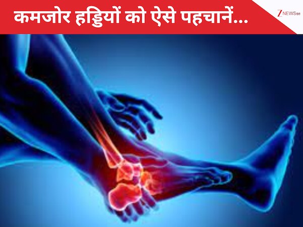 Bone Damage Early Signs How do I know if my bone is damaged |कमजोर होती ...