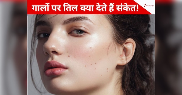 Mole Astrology gal par til ke Sanket mole on cheek prediction | Mole ...