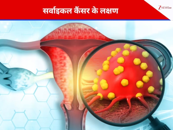 cervical cancer warning symptoms know from dr meera pathak | भारत में ...