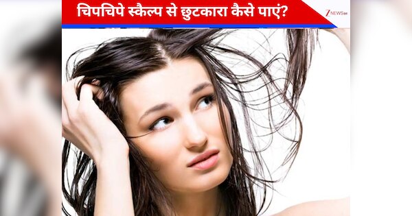How to get rid sticky scalp follow these best desi remedies chipchipe ...