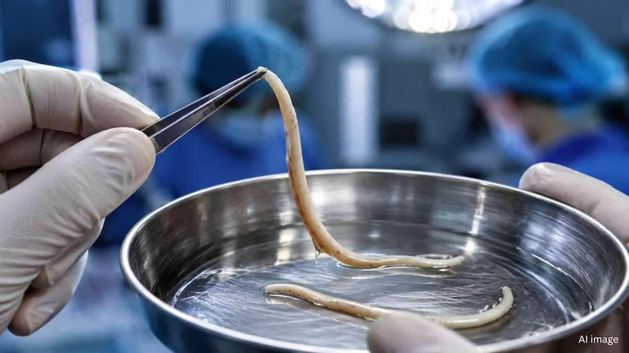 chinese doctors remove 10cm live worms from womans arm after long pain ...