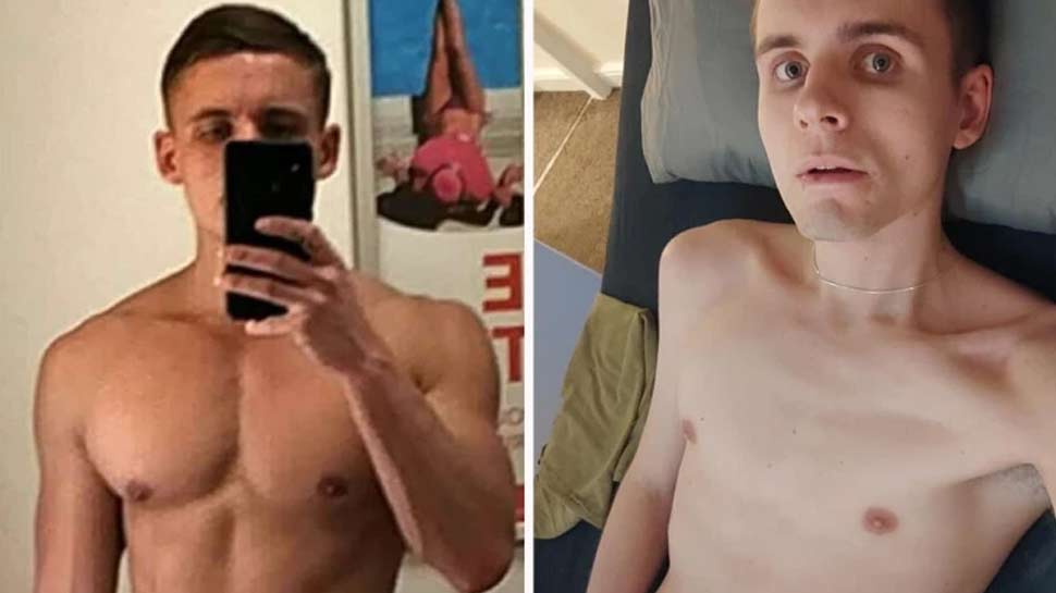 Antibiotics Side Effects Curious Case of Alex Middleton who took High ...